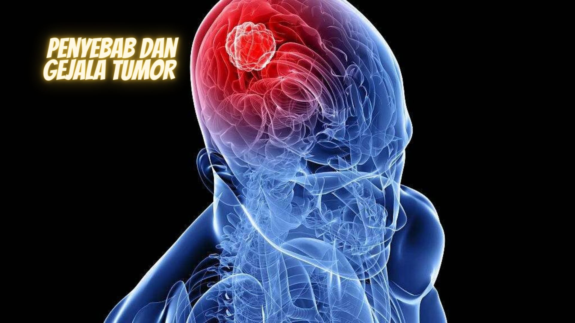 Pengenalan Tentang Tumor: Penyebab dan Gejala – Lapakaku.com